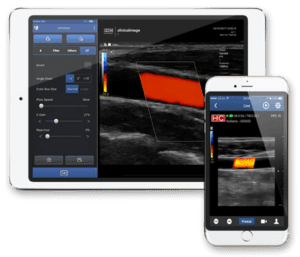 Sonon 500L - Sonon handheld wireless ultrasound
